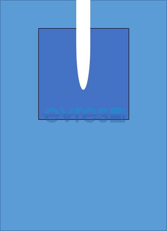 Split Drape - Evres Healthcare Manufacturing